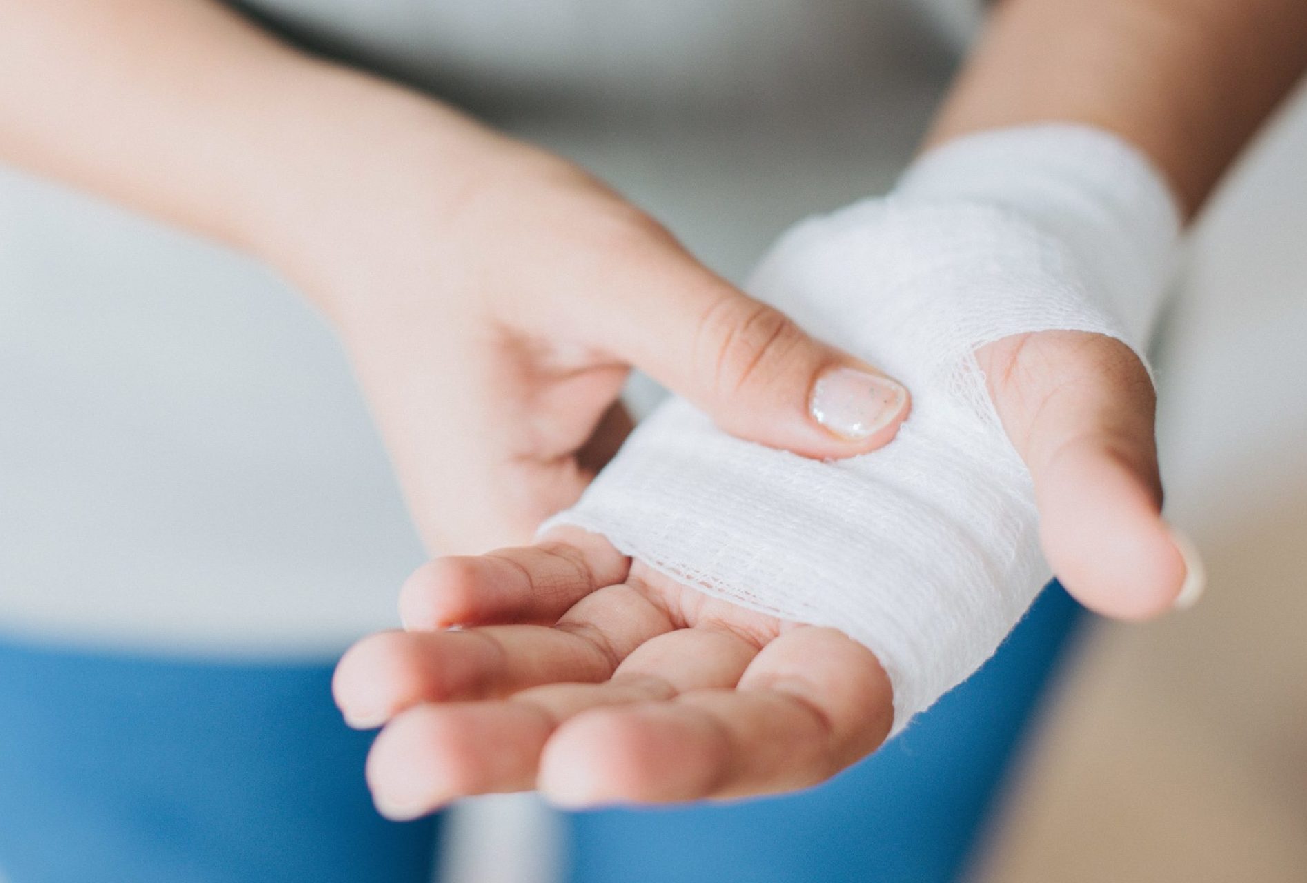 Saps què fer davant d’una cremada? - Primers auxilis - Ciència Oberta